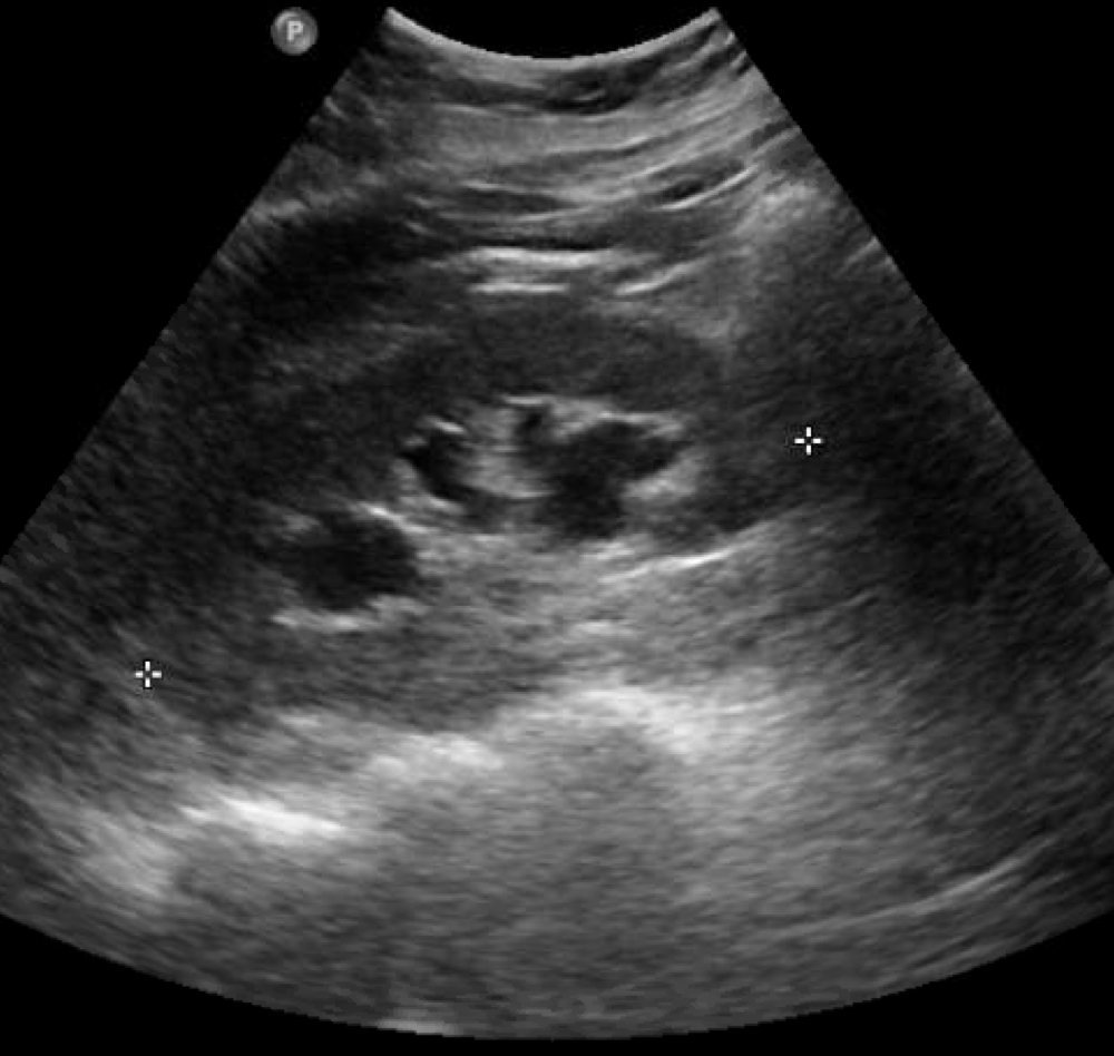 Image Gallery Nephsim - NephSIM