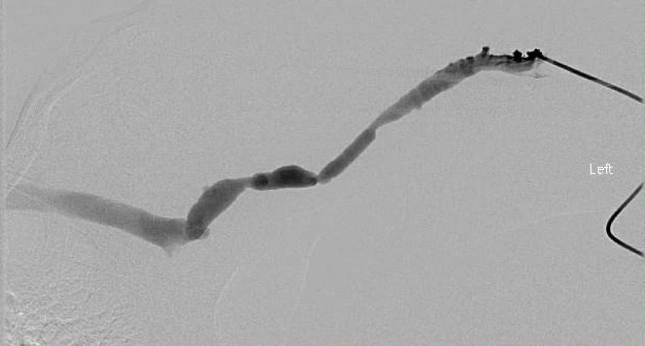 Image Gallery Nephsim - NephSIM