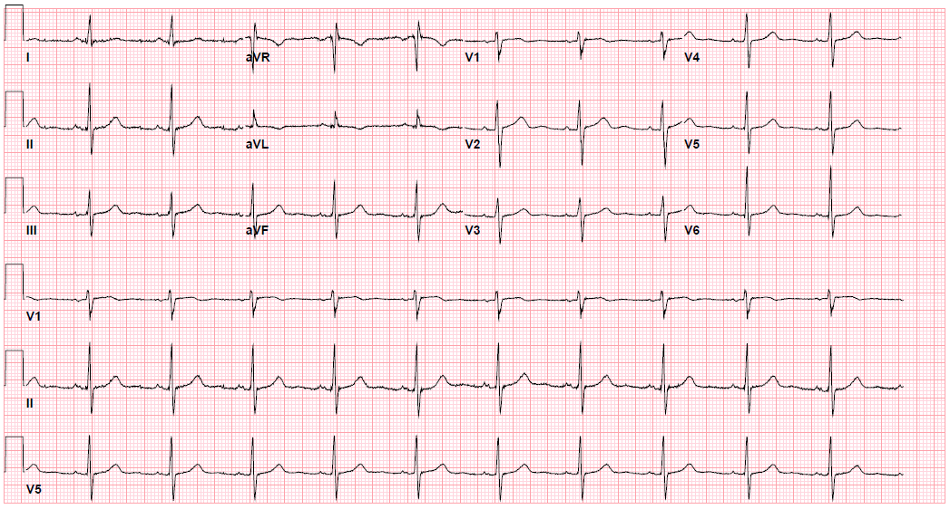 Case 27: Diagnostic Testing – NephSIM