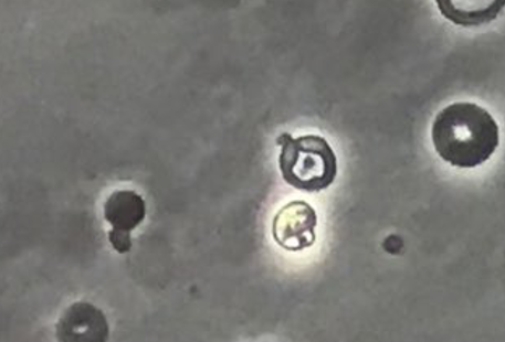 Case 43: Diagnosis & Conclusions