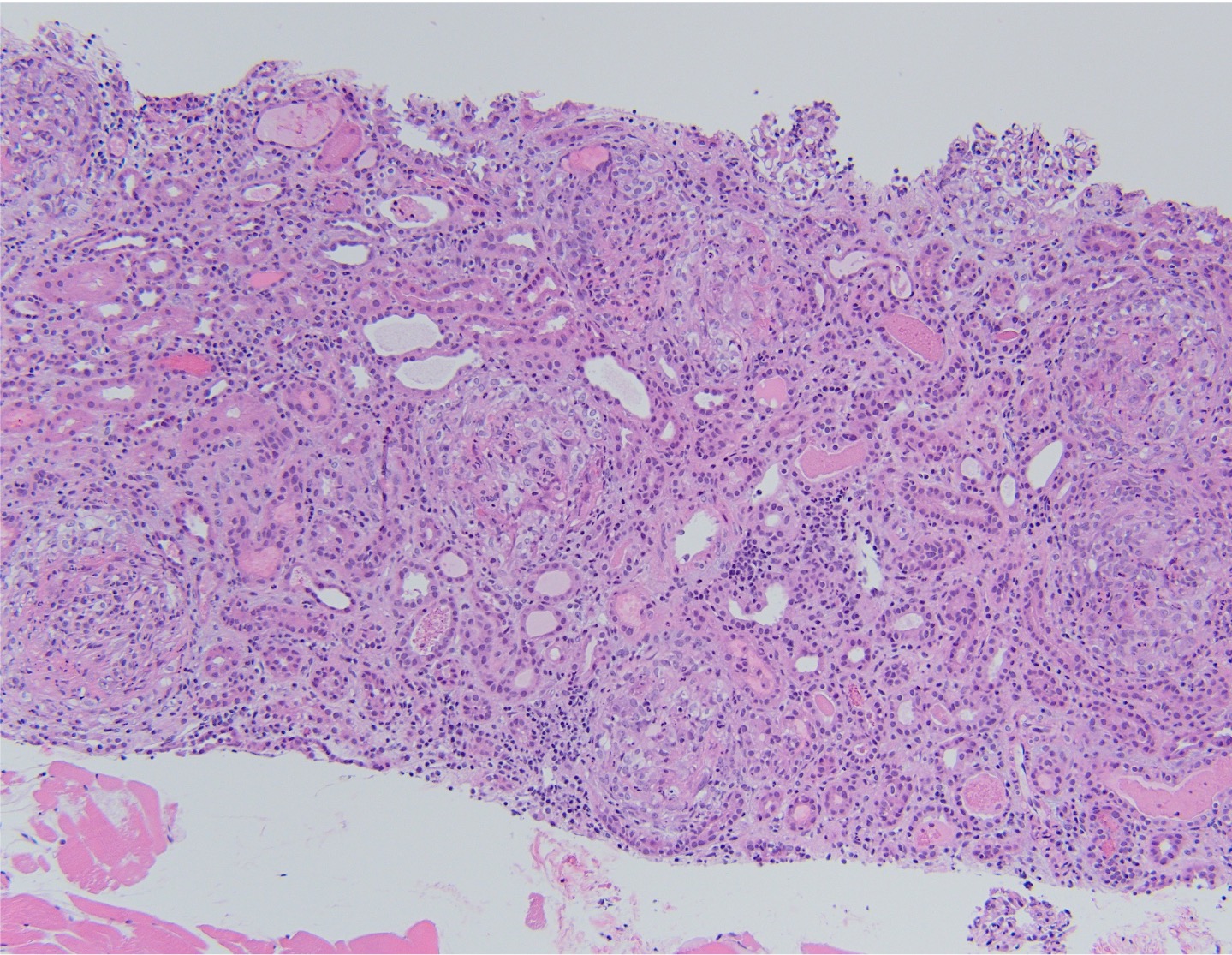 Case 56: Pathology [Pediatrics]